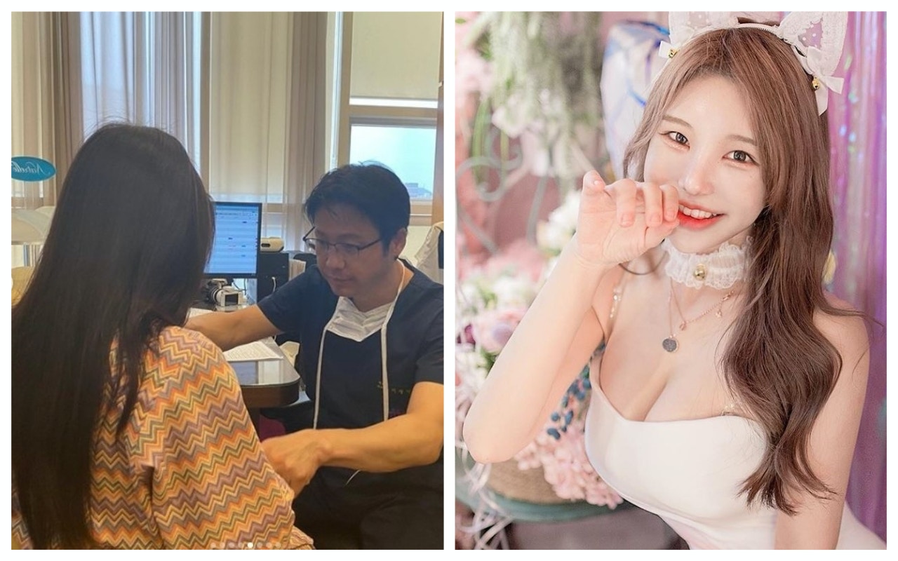 【多圖】韓模Zzyuri上圍太豐滿被指隆胸 公開X光片力證真材實料