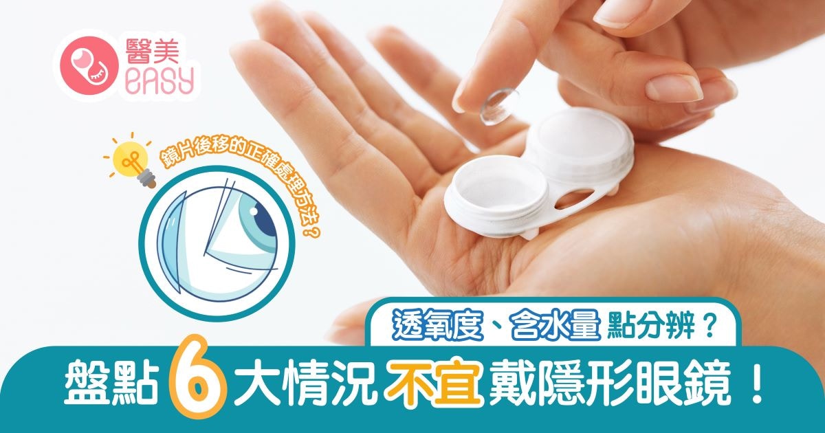 隱形眼鏡只能戴十年?一文揭露各種禁忌、迷思真假|醫師easy