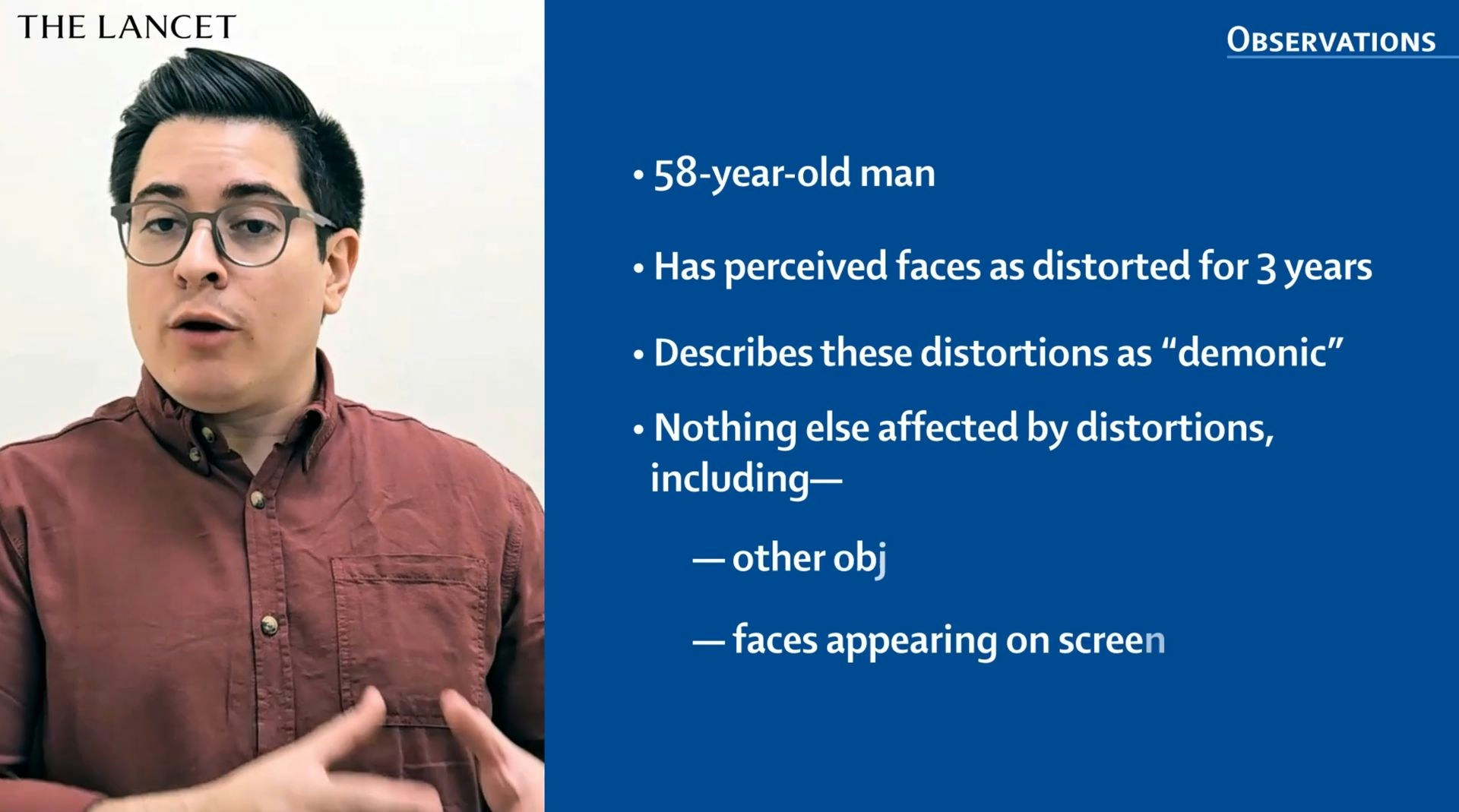 美國男突患怪病「看到的人臉全變妖怪」 清秀美女在他眼中長這樣｜醫師Easy